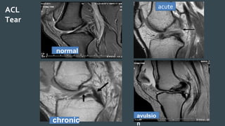 mri in orthopaedics its importance and understanding | PPT
