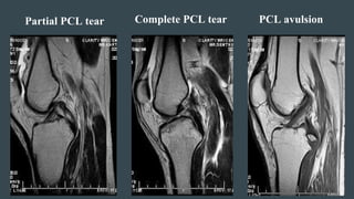 mri in orthopaedics its importance and understanding | PPT