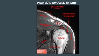 mri in orthopaedics its importance and understanding | PPT