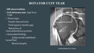 mri in orthopaedics its importance and understanding | PPT