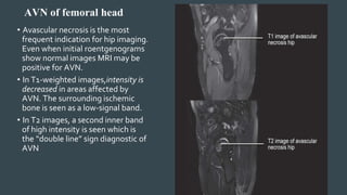 mri in orthopaedics its importance and understanding | PPT