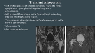 mri in orthopaedics its importance and understanding | PPT