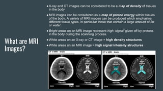 mri in orthopaedics its importance and understanding | PPT