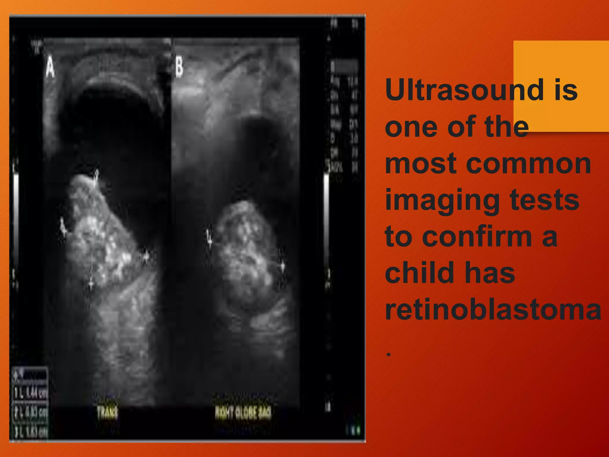 MRI Abnormalities.pptx