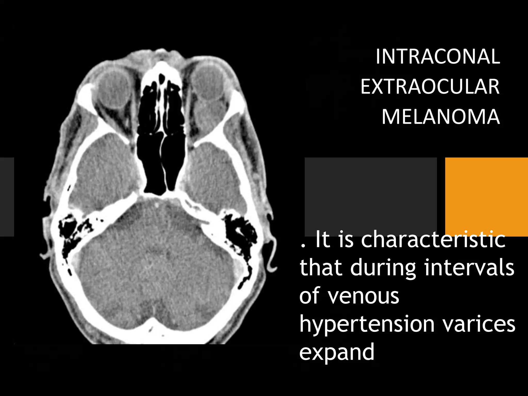 MRI Abnormalities.pptx