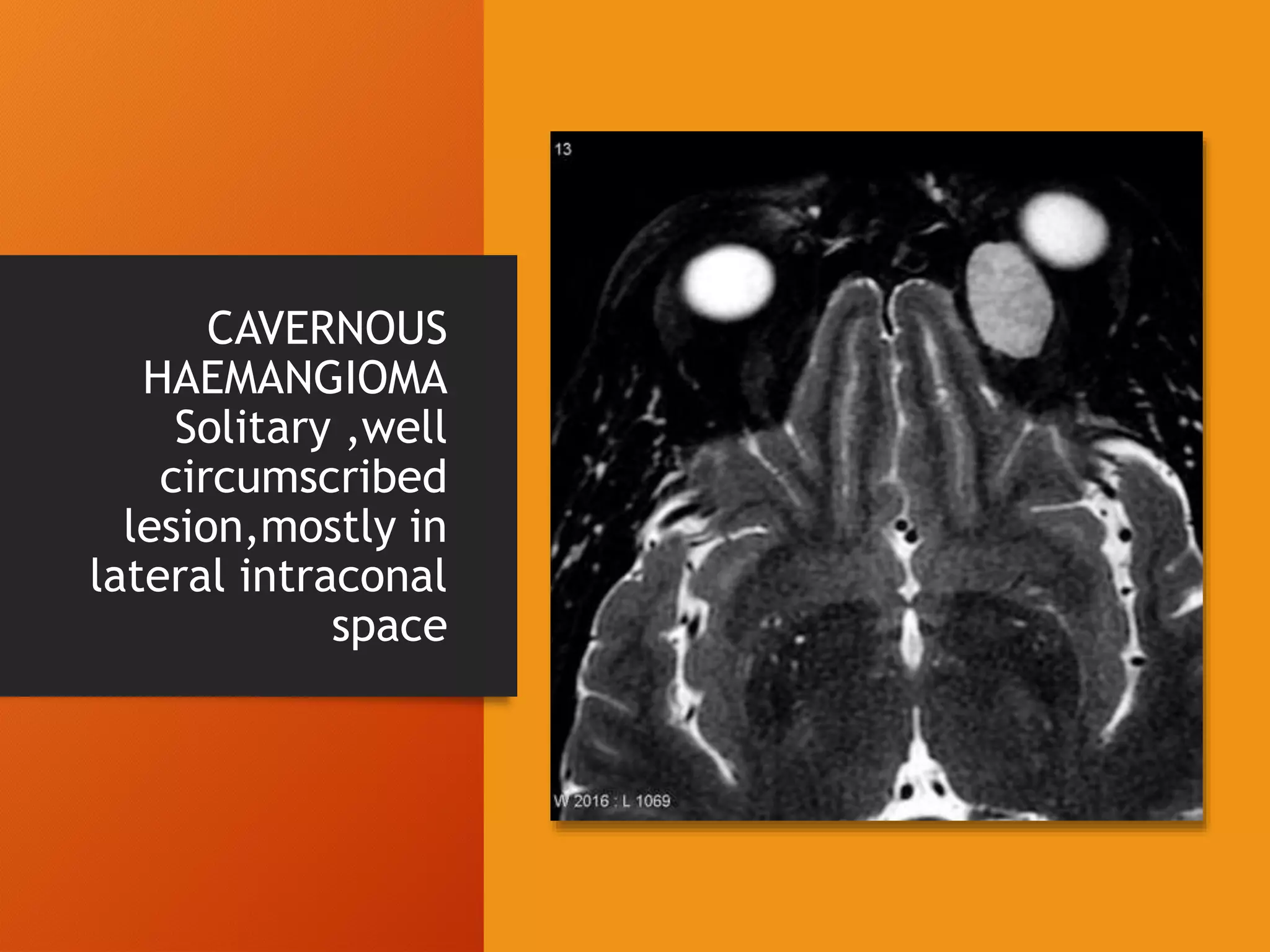 MRI Abnormalities.pptx