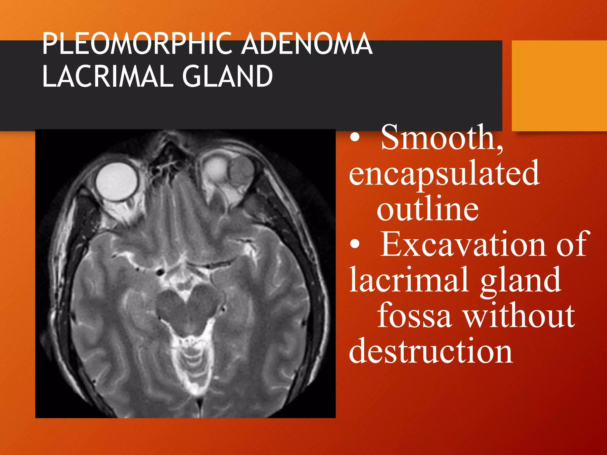 MRI Abnormalities.pptx