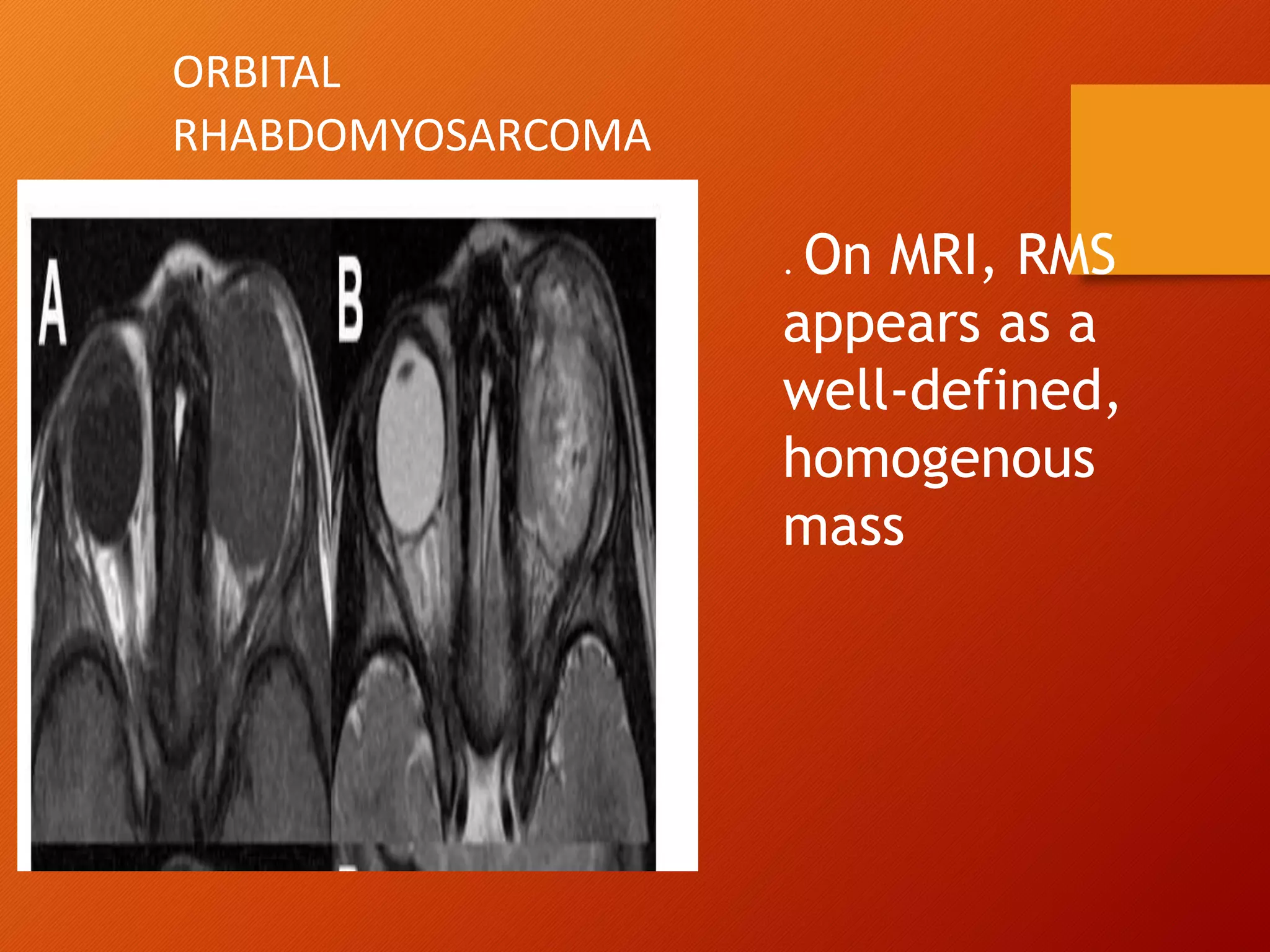 MRI Abnormalities.pptx