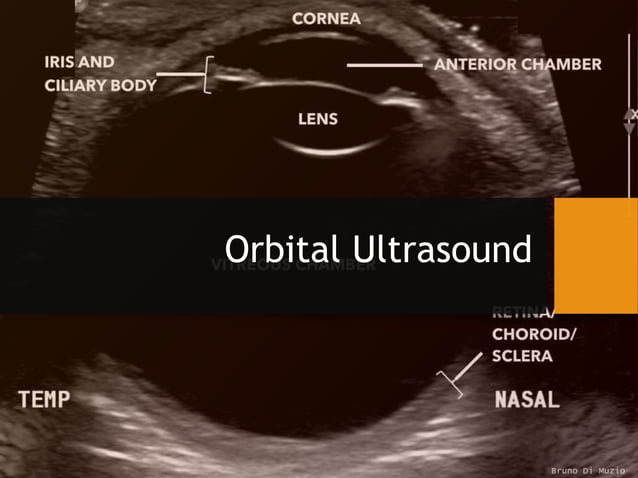 MRI Abnormalities.pptx