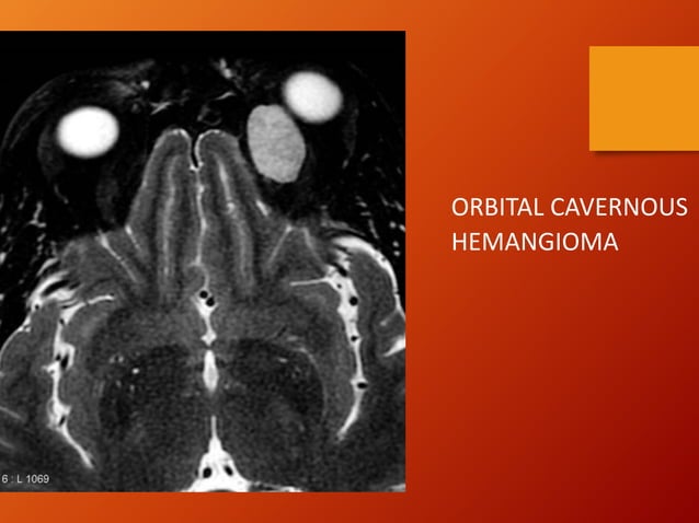 MRI Abnormalities.pptx