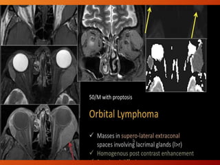 MRI Abnormalities.pptx