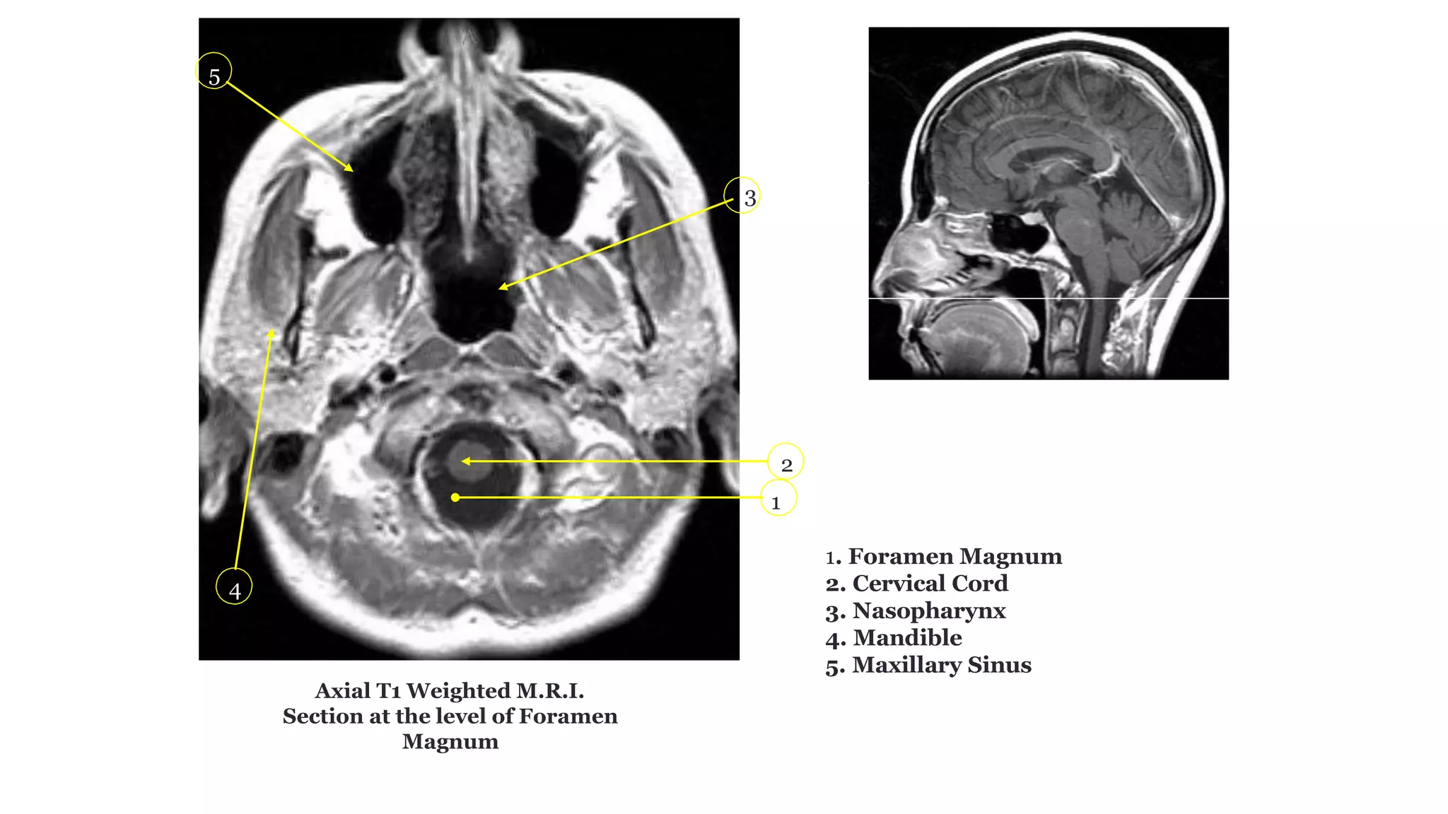 mri anatomy.pptx