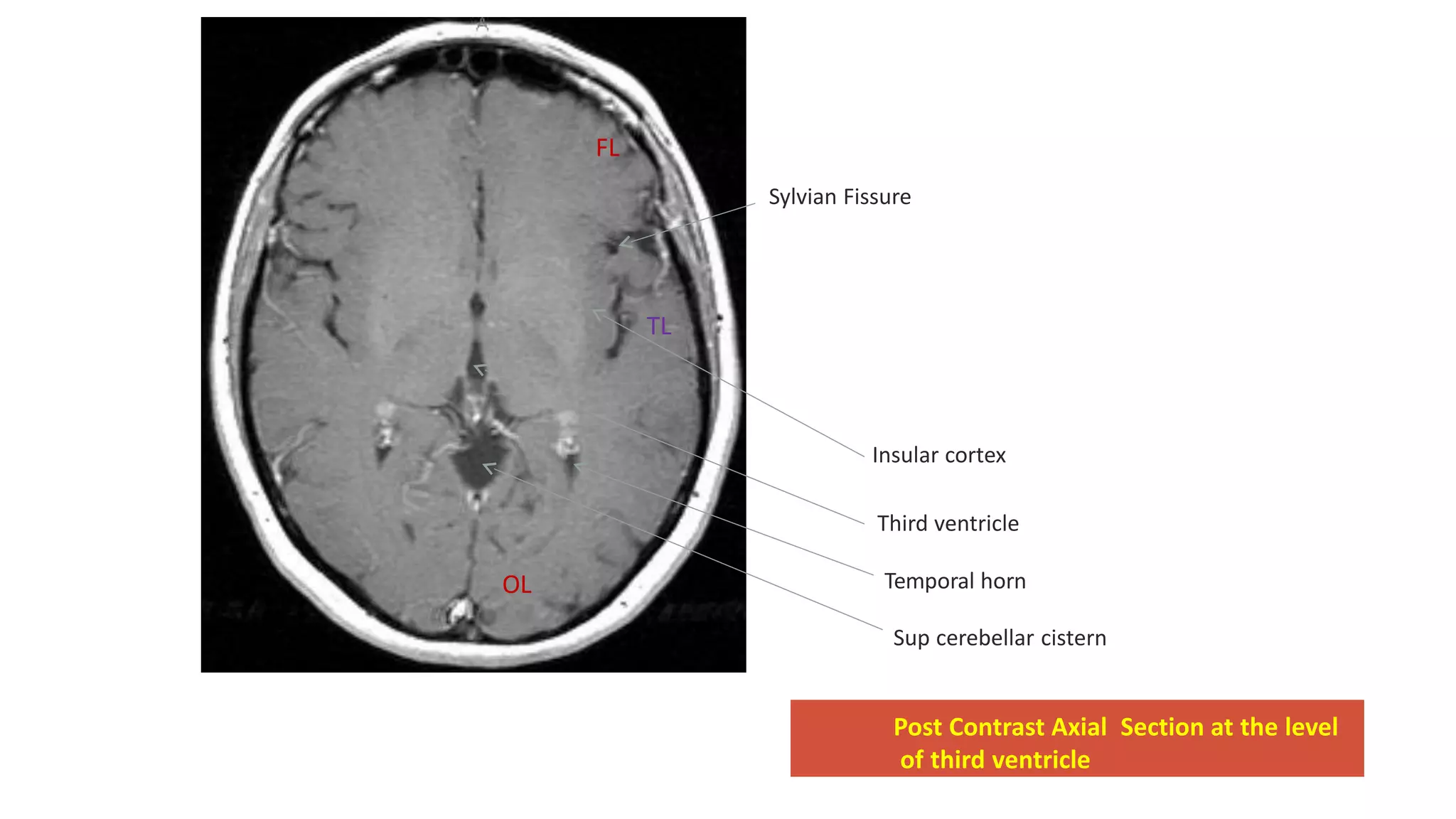 mri anatomy.pptx