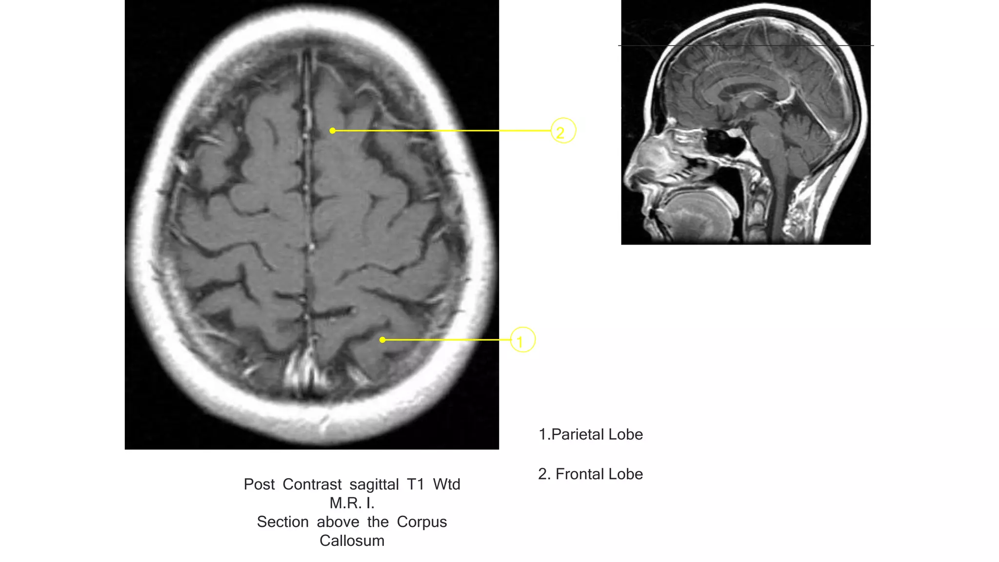 mri anatomy.pptx