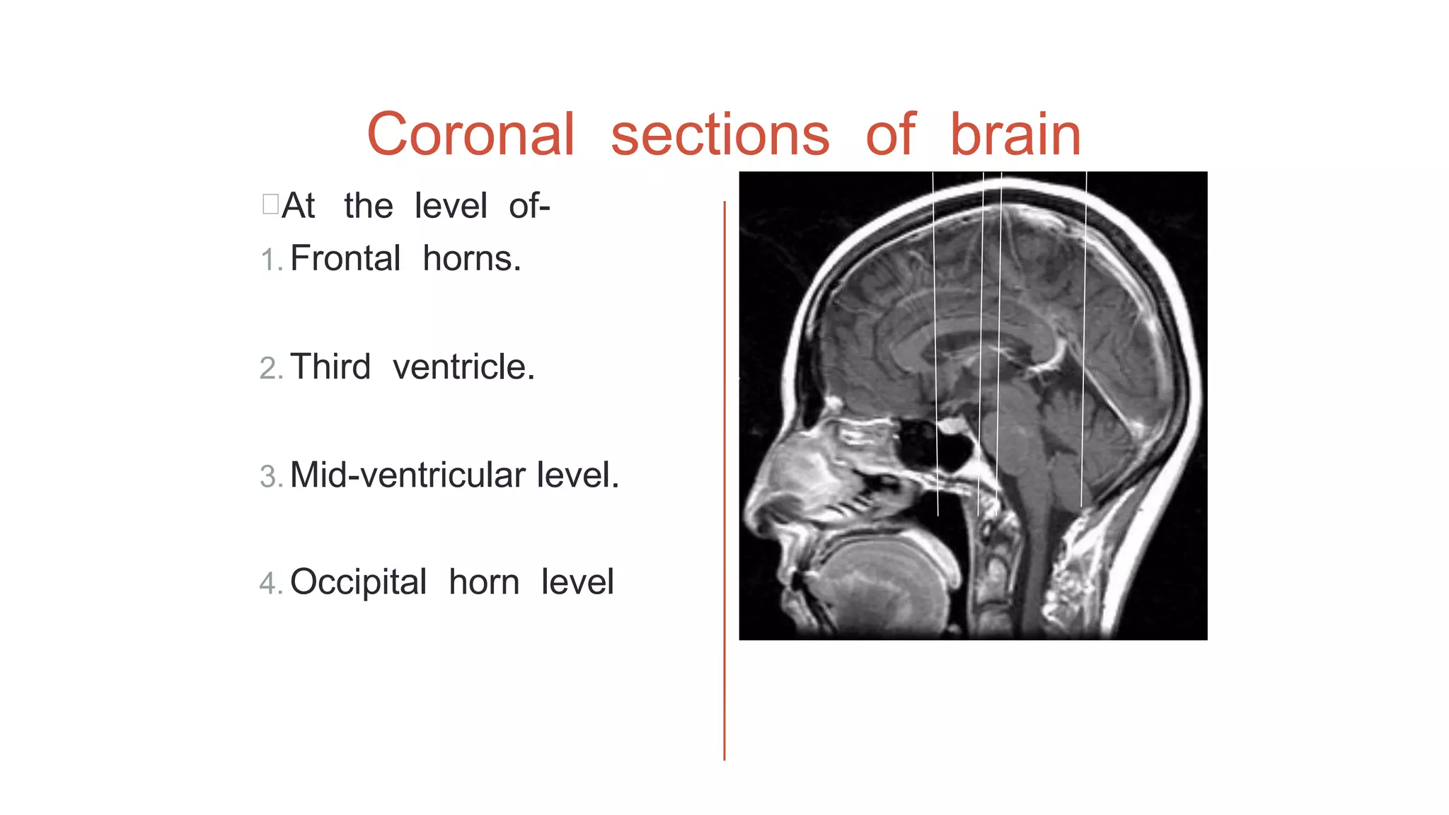 mri anatomy.pptx