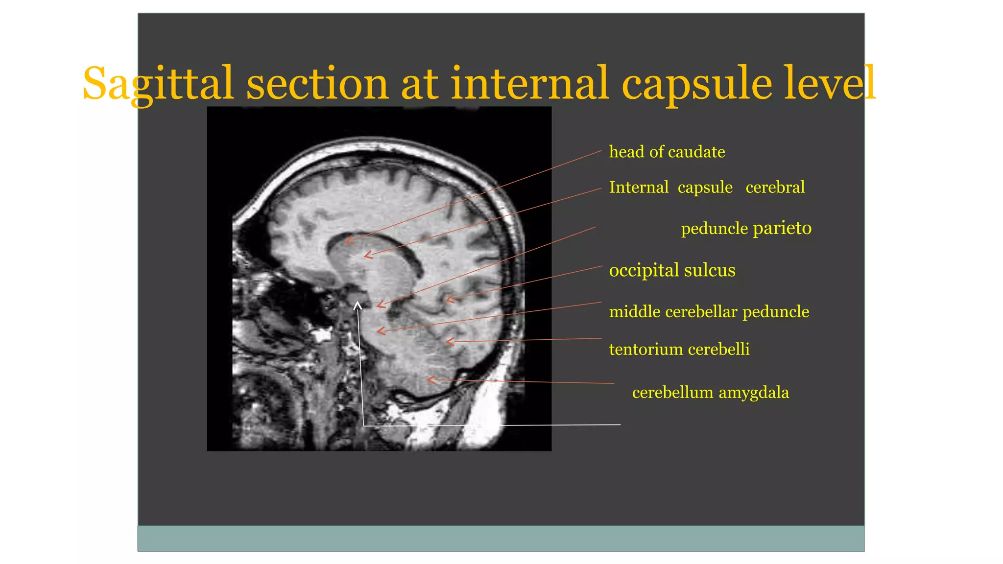 mri anatomy.pptx