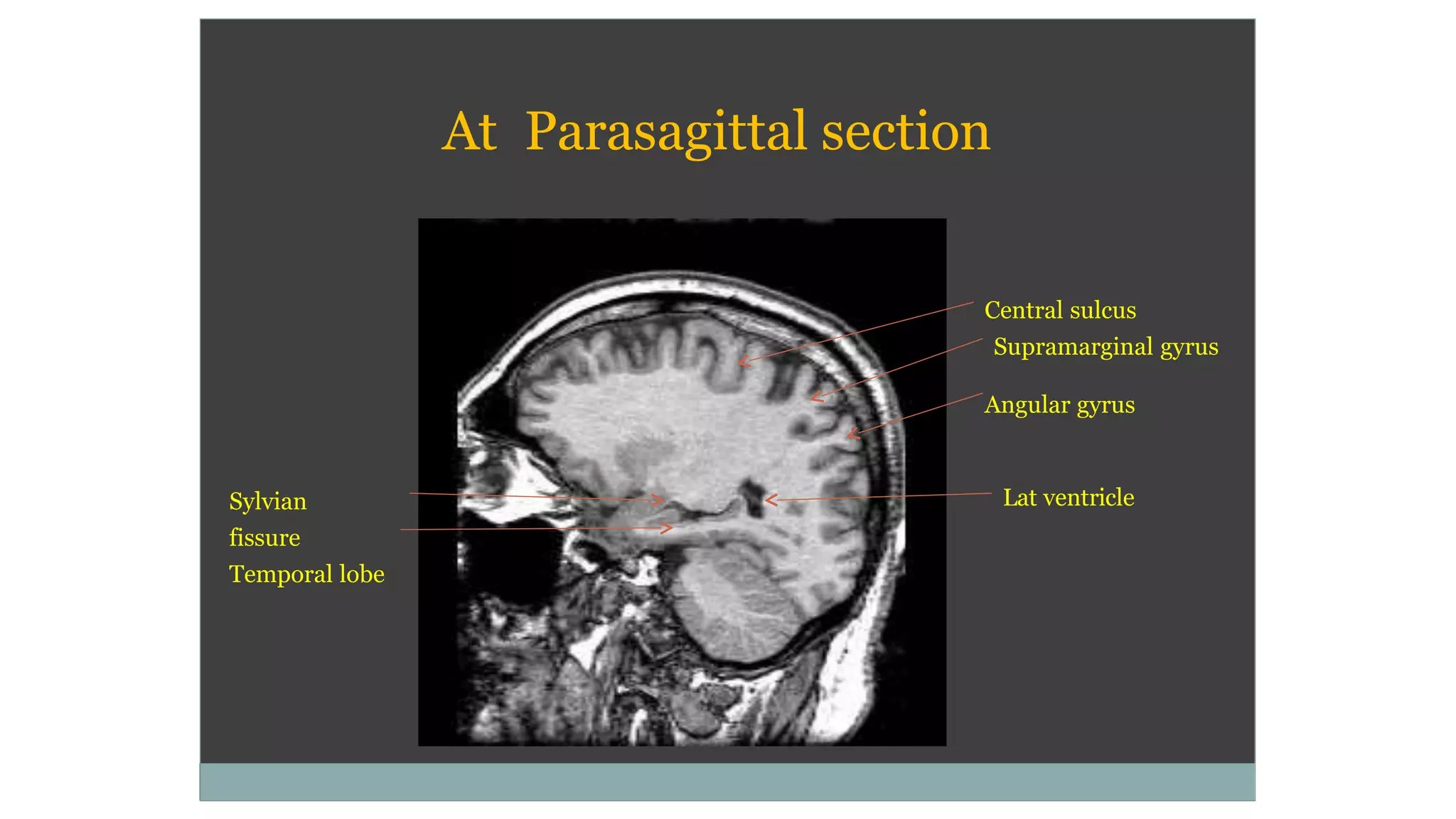 mri anatomy.pptx