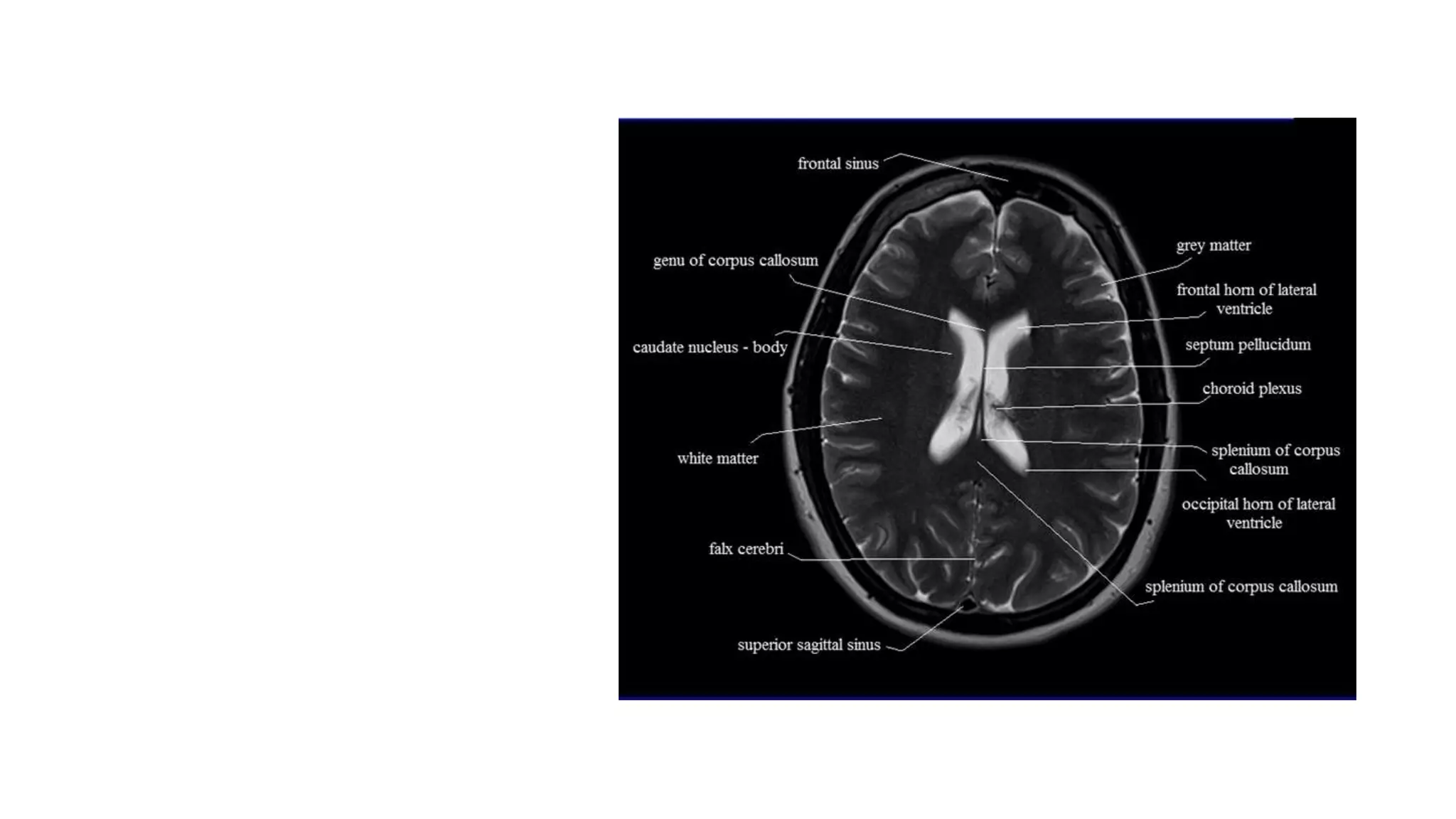 mri anatomy.pptx