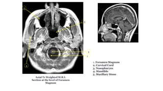 mri anatomy.pptx