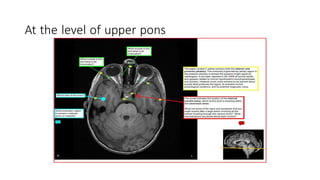 mri anatomy.pptx
