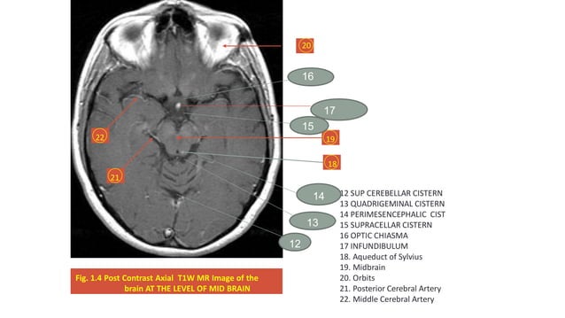 mri anatomy.pptx