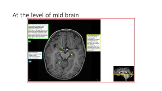 mri anatomy.pptx