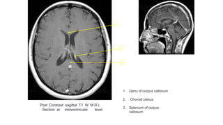 mri anatomy.pptx