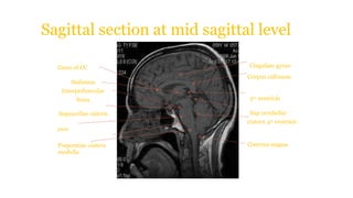 mri anatomy.pptx