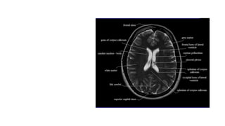 mri anatomy.pptx