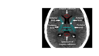 mri anatomy.pptx