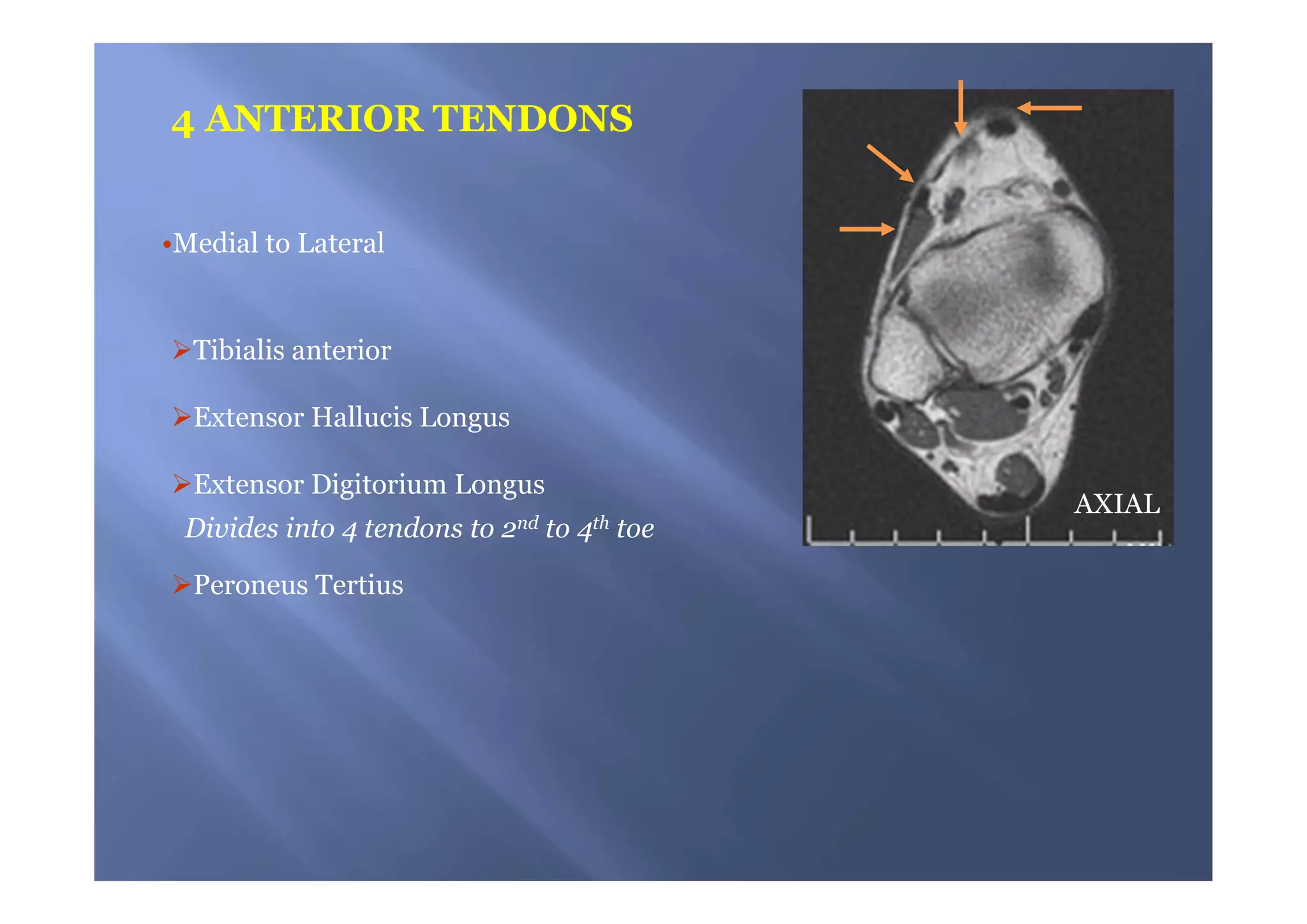 Mri anatomy of ankle | PDF