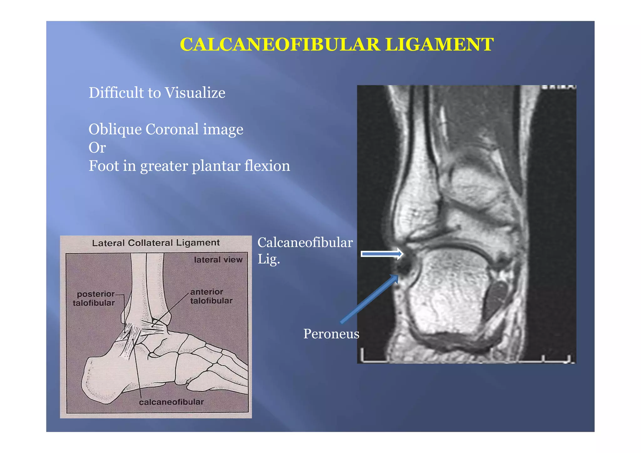 Mri anatomy of ankle | PDF