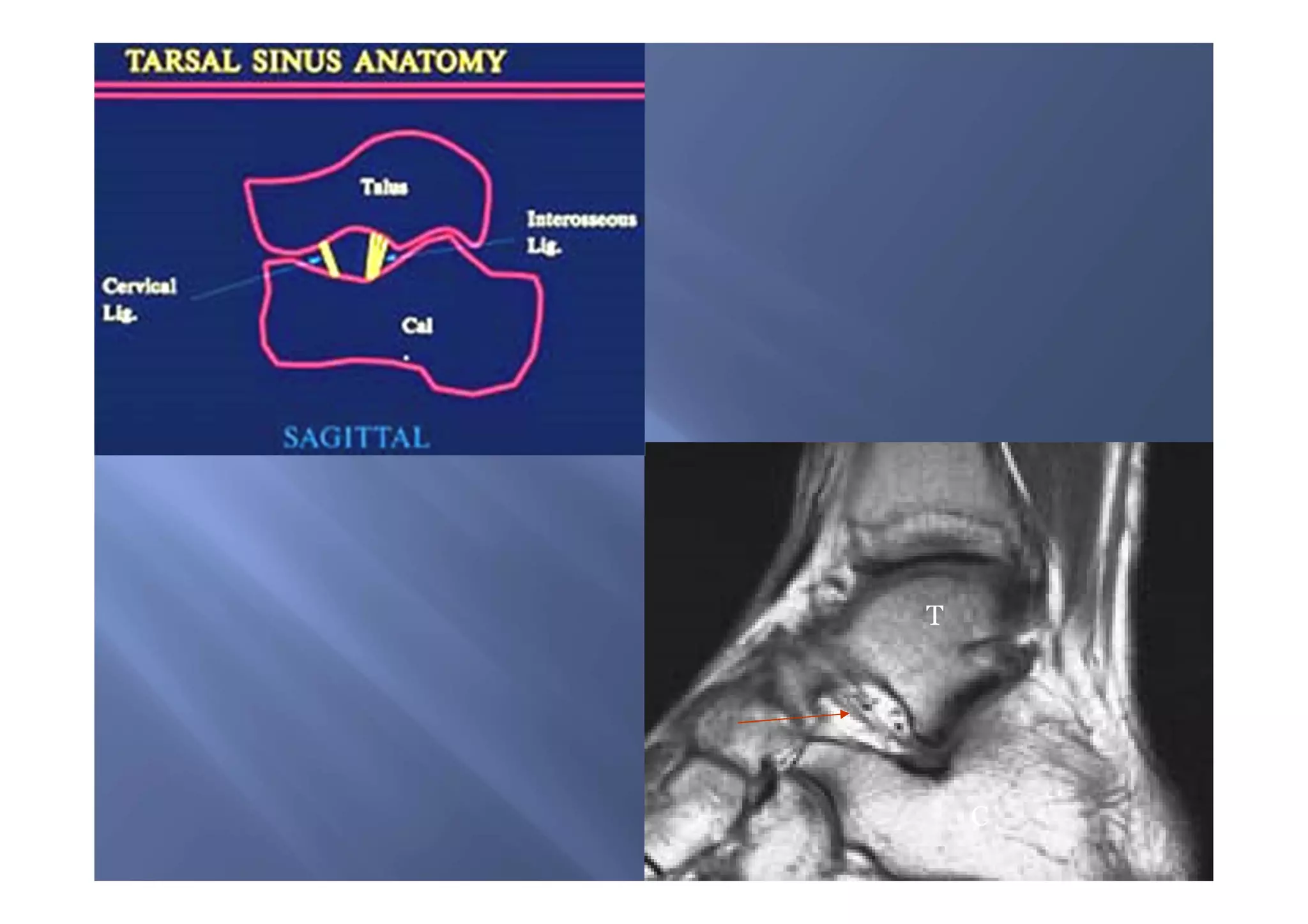 Mri anatomy of ankle | PDF