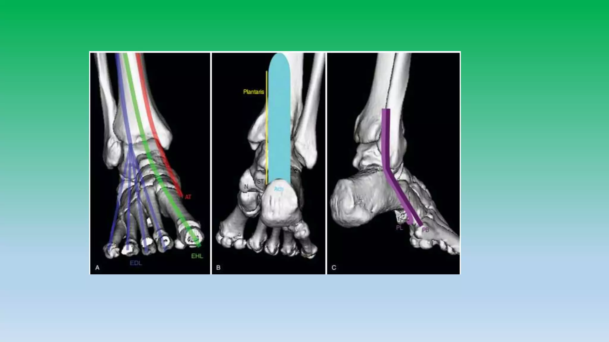 Mri anatomy of ankle radiology ppt pk | PPTX