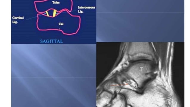 Mri anatomy of ankle radiology ppt pk | PPTX