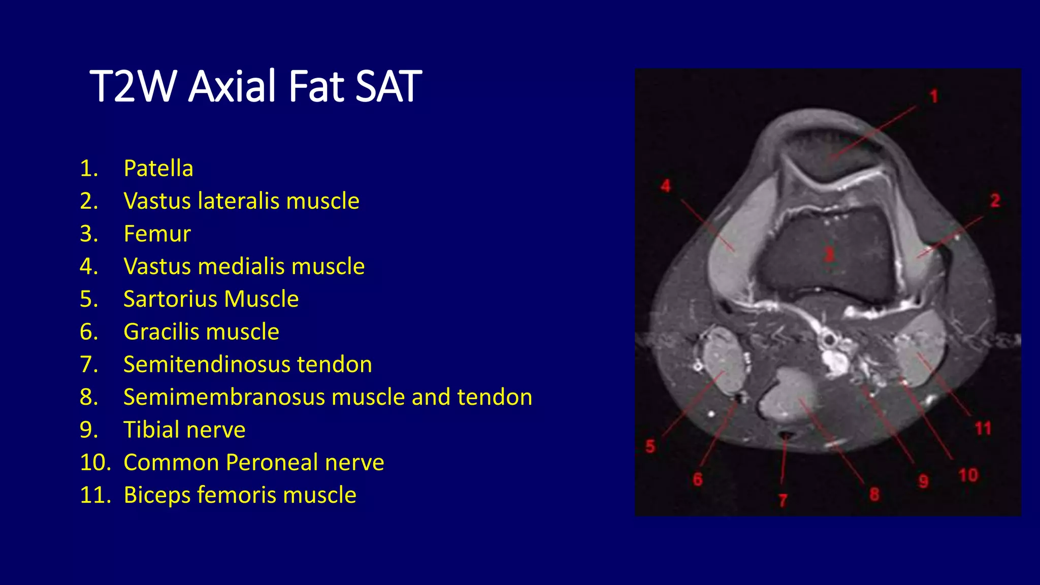 Mri anatomy of knee Dr. Muhammad Bin Zulfiqar | PPTX