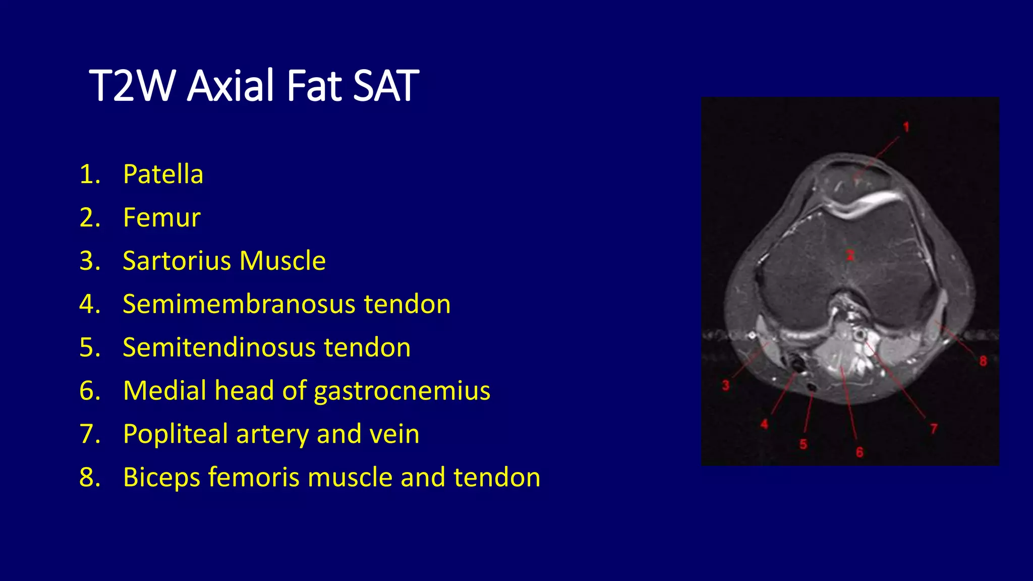 Mri anatomy of knee Dr. Muhammad Bin Zulfiqar | PPTX