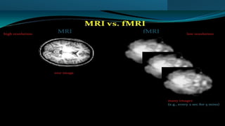 MRI and fMRI lifesciences and neurology ppt | PPTX