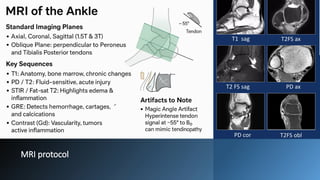 MRI ANKLE and various pathology interpretation | PPTX