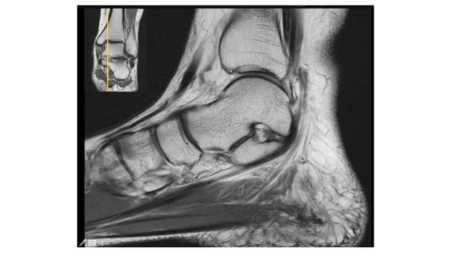 MRI ANKLE ANATOMY.pptx