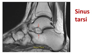 MRI ANKLE ANATOMY.pptx