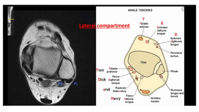 MRI ANKLE ANATOMY.pptx