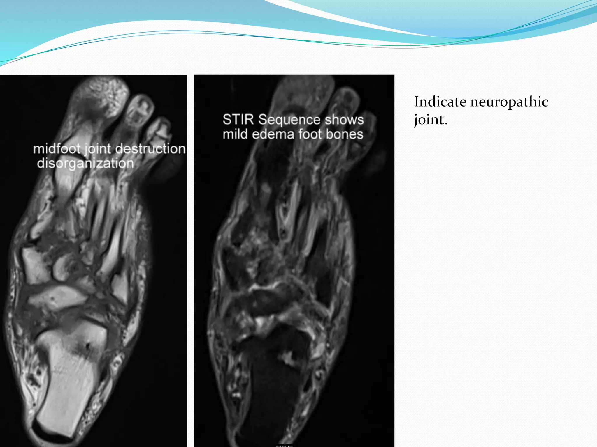 MRI- ankle techniques | PPTX