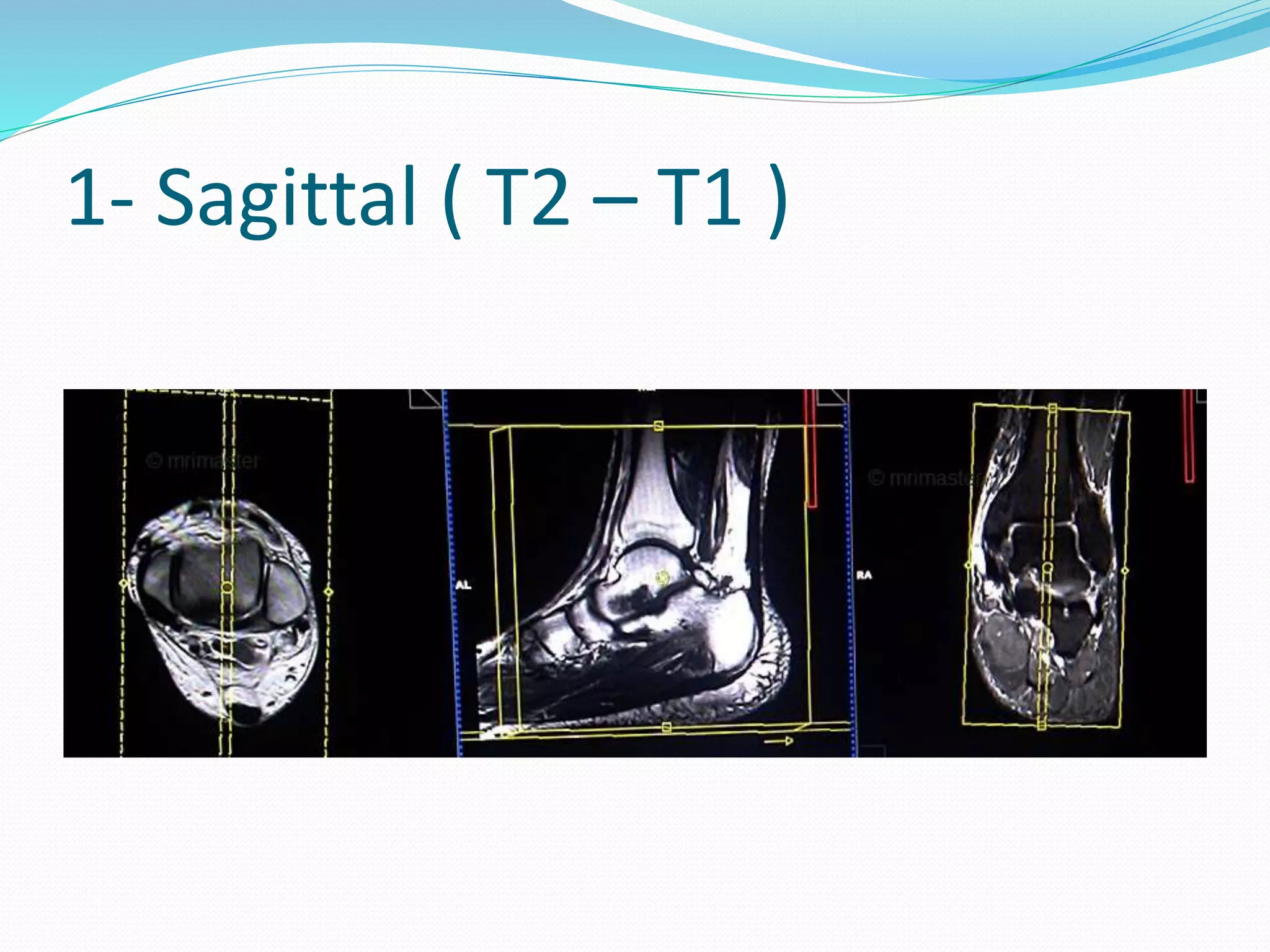 MRI- ankle techniques | PPTX
