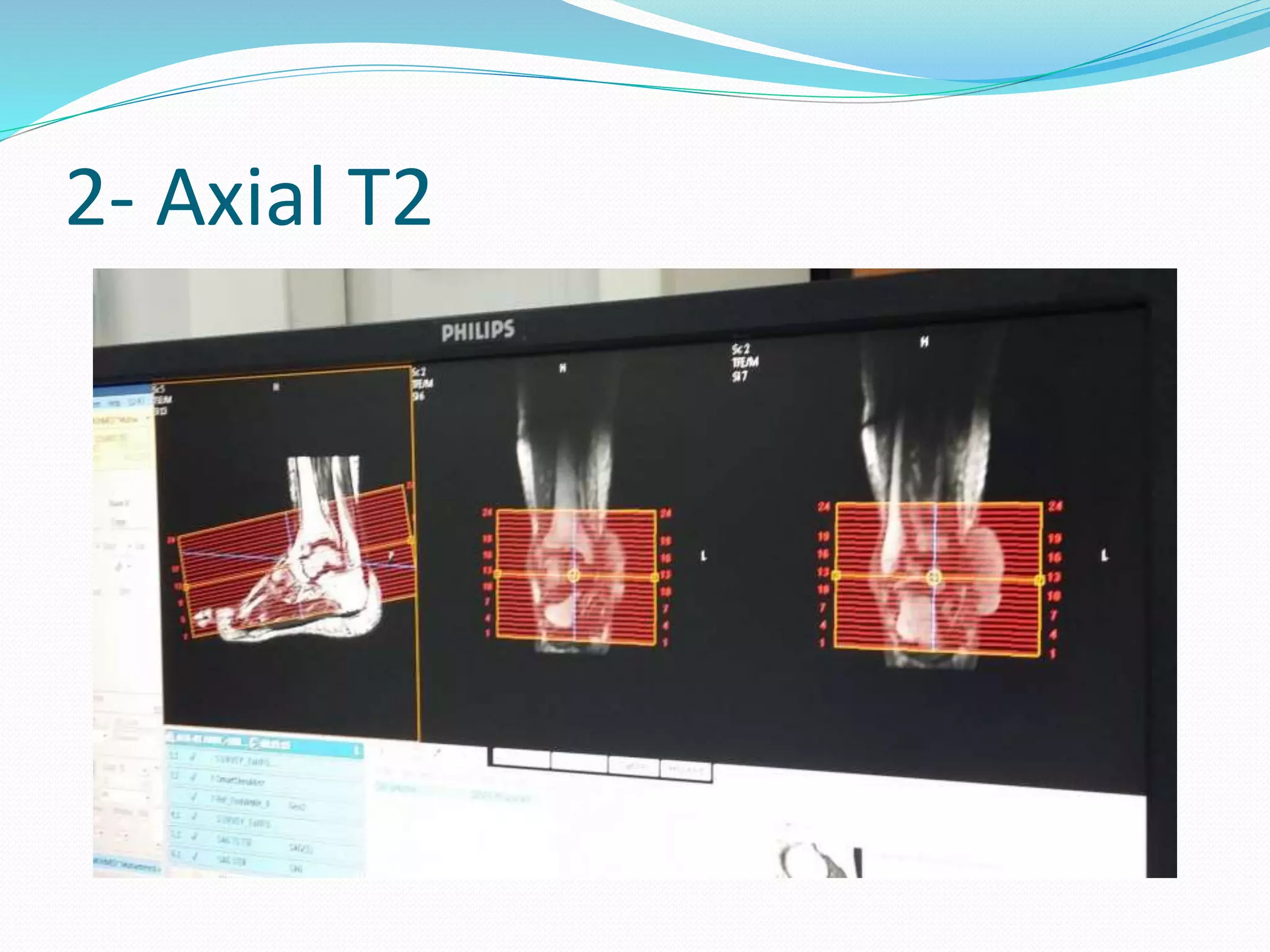 MRI- ankle techniques | PPTX