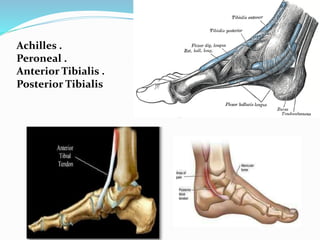 MRI- ankle techniques | PPTX