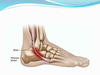 MRI- ankle techniques | PPTX