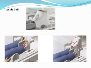 MRI- ankle techniques | PPTX