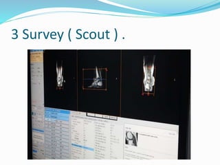 MRI- ankle techniques | PPTX