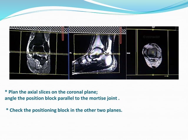 MRI- ankle techniques | PPTX | Death, Injury, or Military Conflict ...